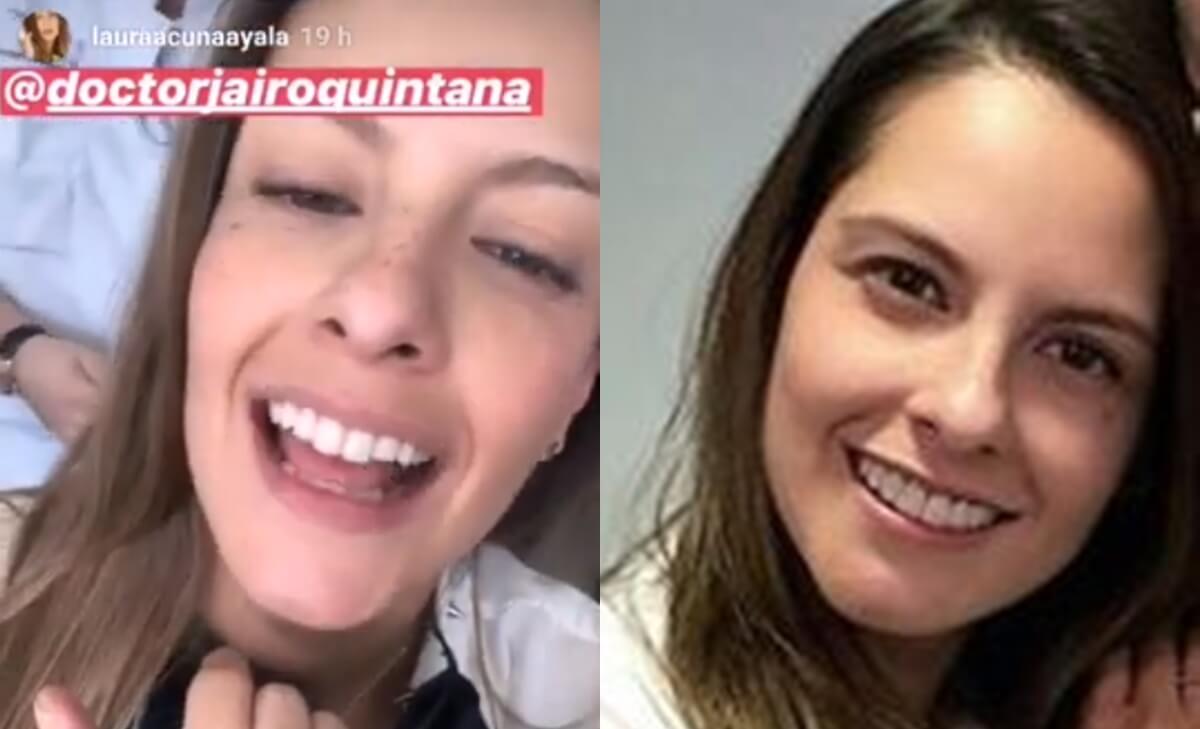 Videos de Laura Acuña revelan sus verdaderos dientes