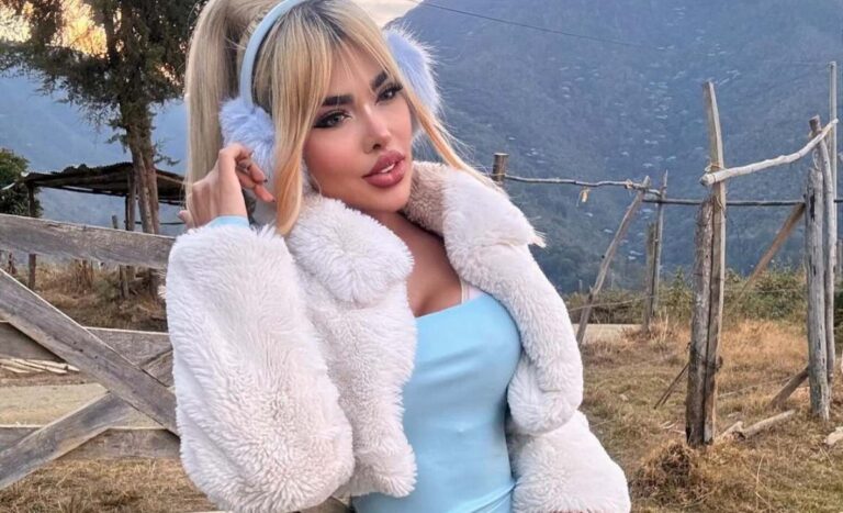 Antes y después de La Barbie colombiana - Vibra