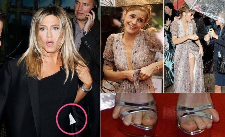 Descuidos De Las Famosas Y Famosos Con La Ropa ¡qué Oso