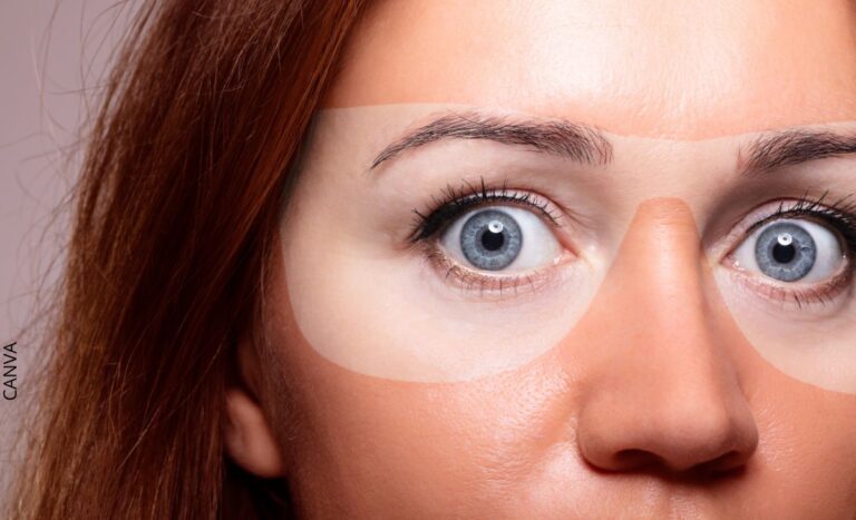 Mascarilla casera para la quemadura del sol, ¡muy efectiva!