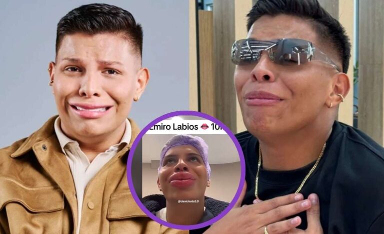 video de Emiro Navarro cuando se hizo procedimiento estético en los labios